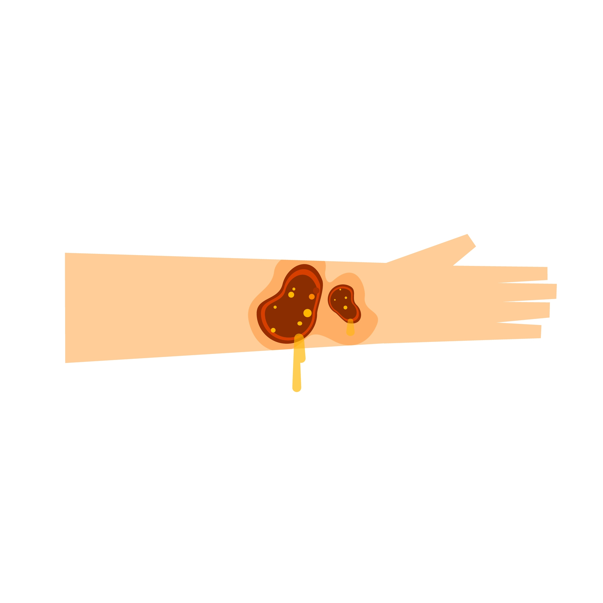 Services - All About Wound Care